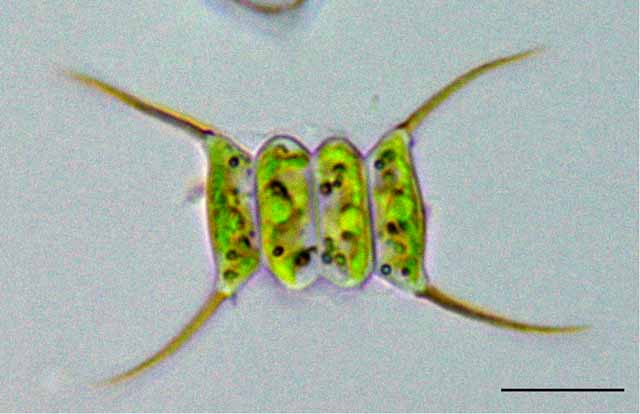微細藻類の画像 - 植物プランクトンの顕微鏡写真集