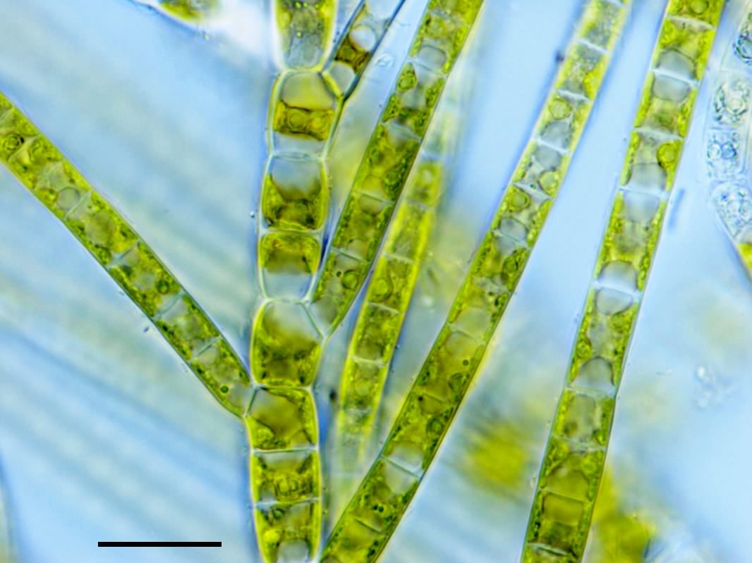 緑色植物門 スティゲオクロニウム（Stigeoclonium）の画像集