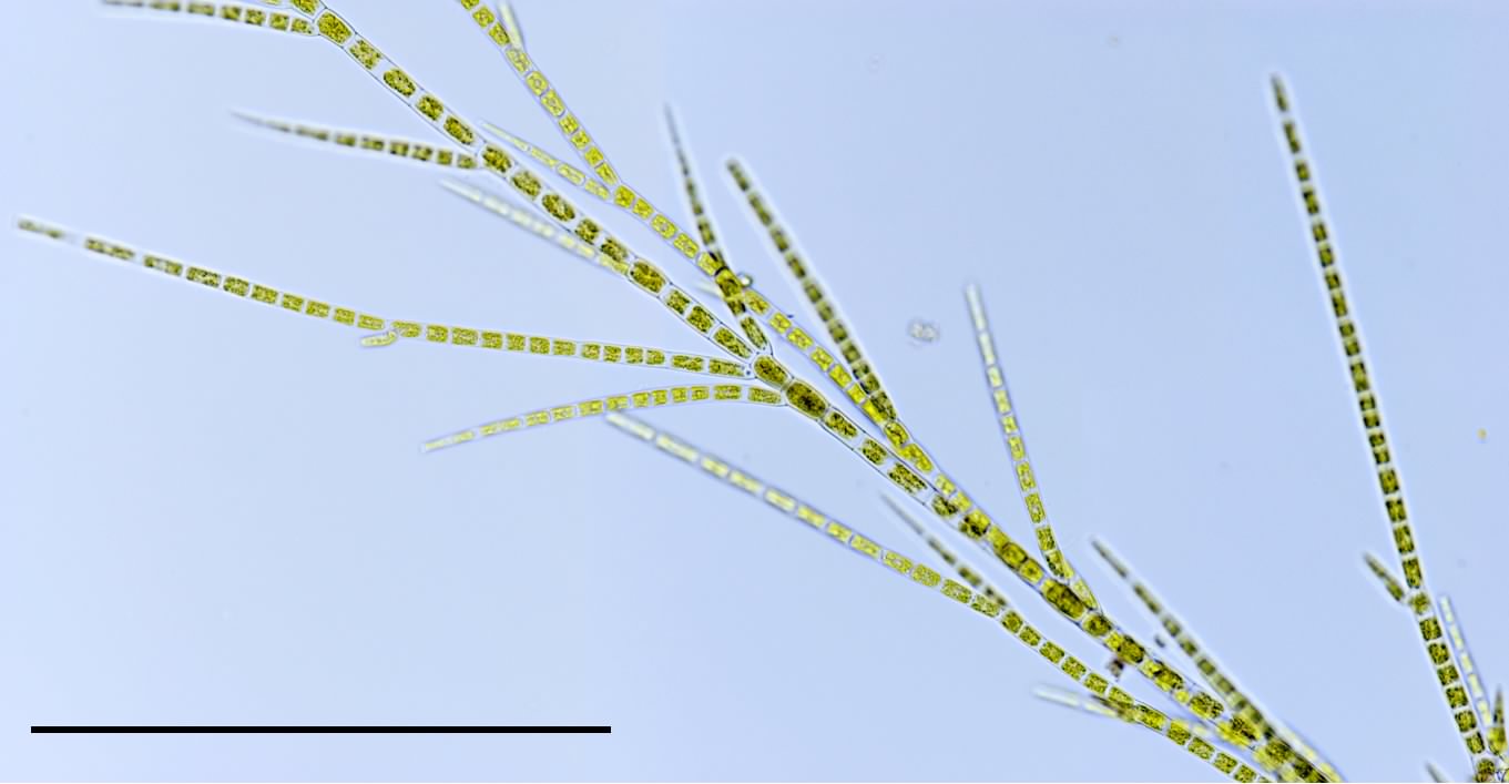 緑色植物門 スティゲオクロニウム（Stigeoclonium）の画像集