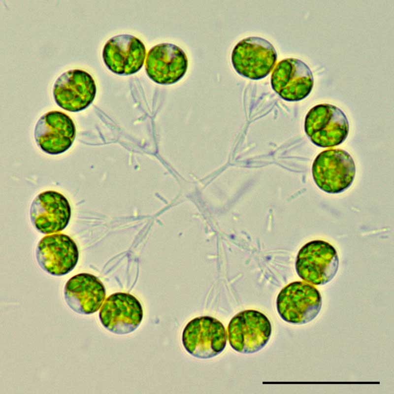 緑色植物門 ディクチオスフェリウム（Dictyosphaerium）の画像集